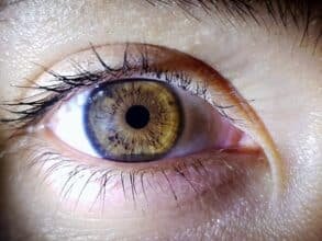What Color Are Hazel Eyes? Exploring Their Golden, Green, and Brown Tones